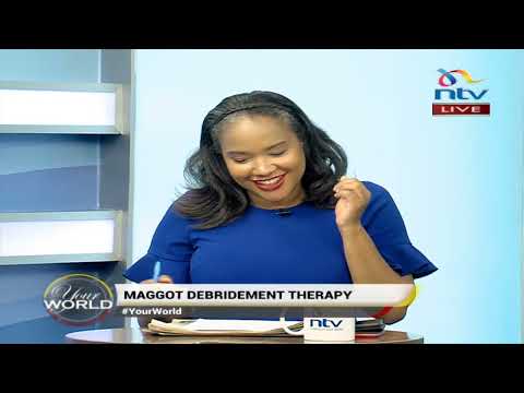 Understanding maggot debridement therapy in Kenya | Your World - YouTube