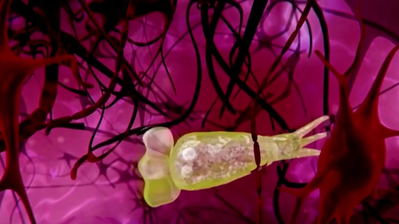 Deadly brain-eating amoeba infects tap water - YouTube