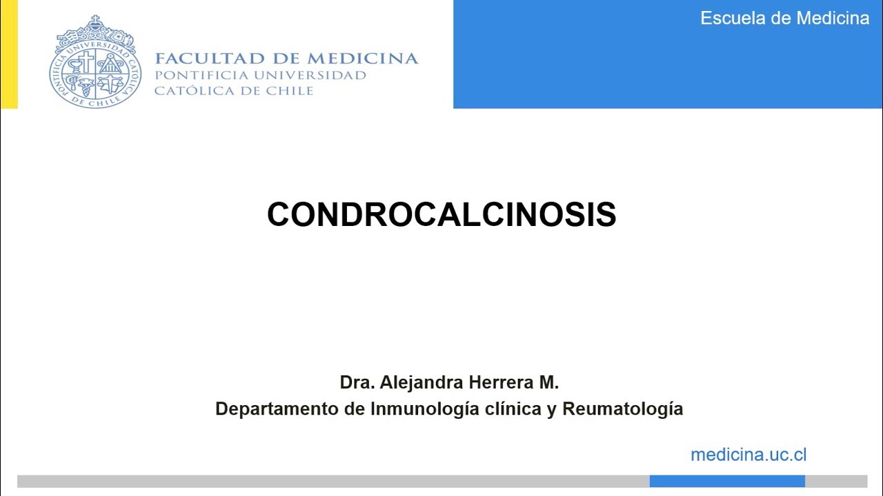 Condrocalcinosis - Reumatología UC - YouTube