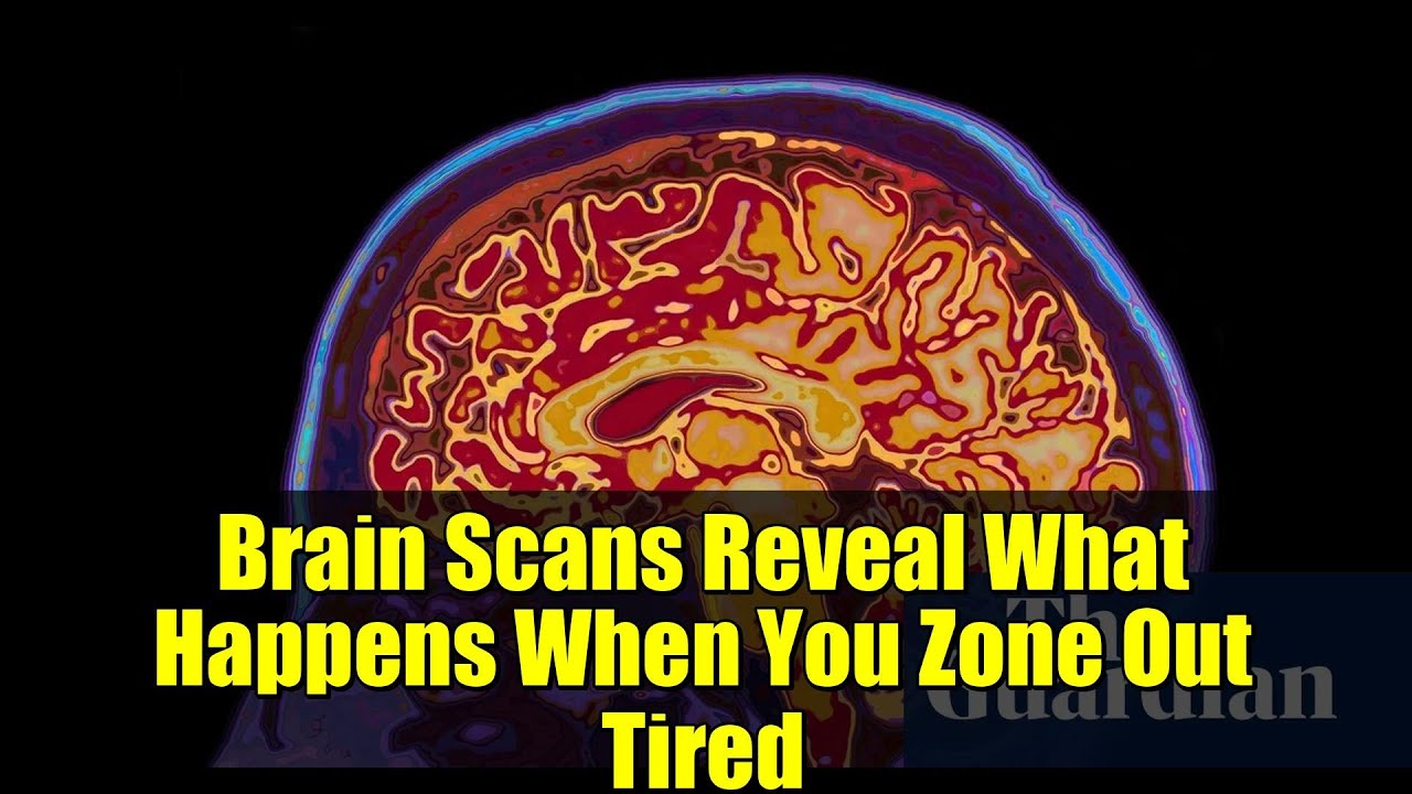 Brain Scans Reveal What Happens When You Zone Out Tired - YouTube