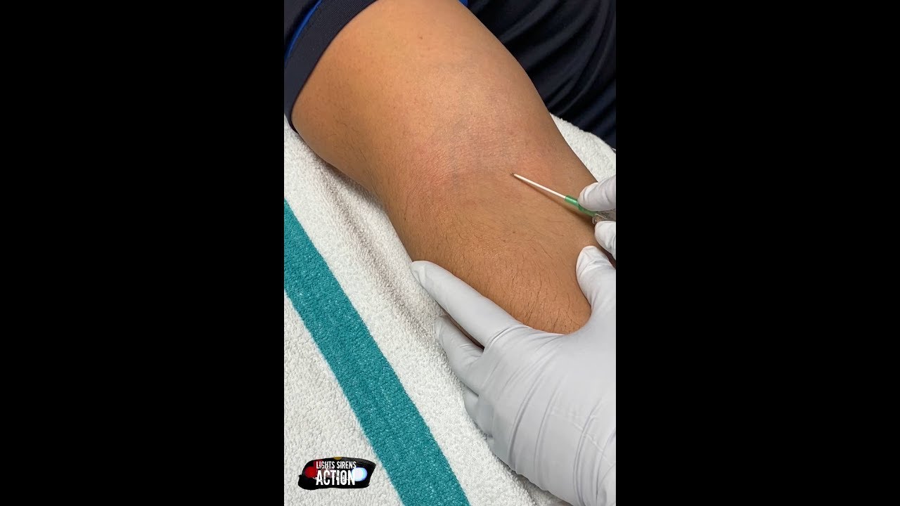 EMS IV INSERTION EXAMPLE || EMS SKILLS - YouTube