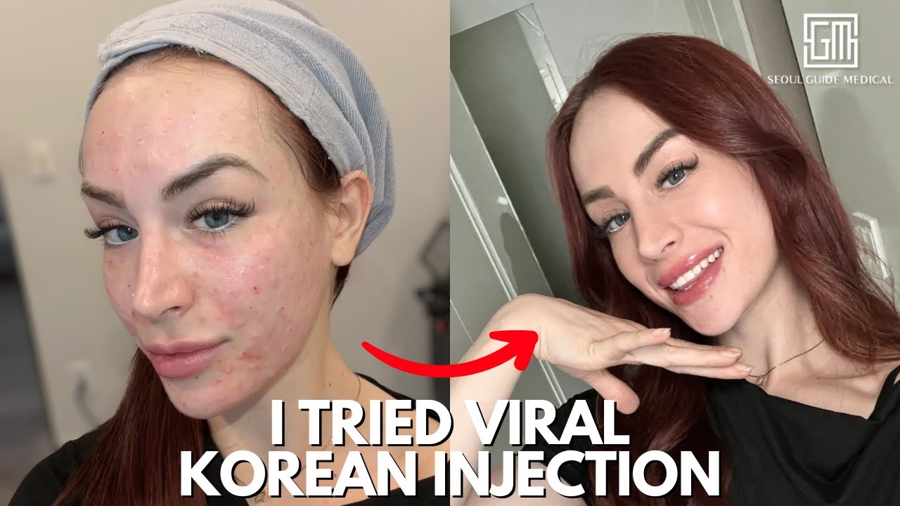 We Tried Korea’s Famous Goddess Injection | Stem Cell Glass Skin ...