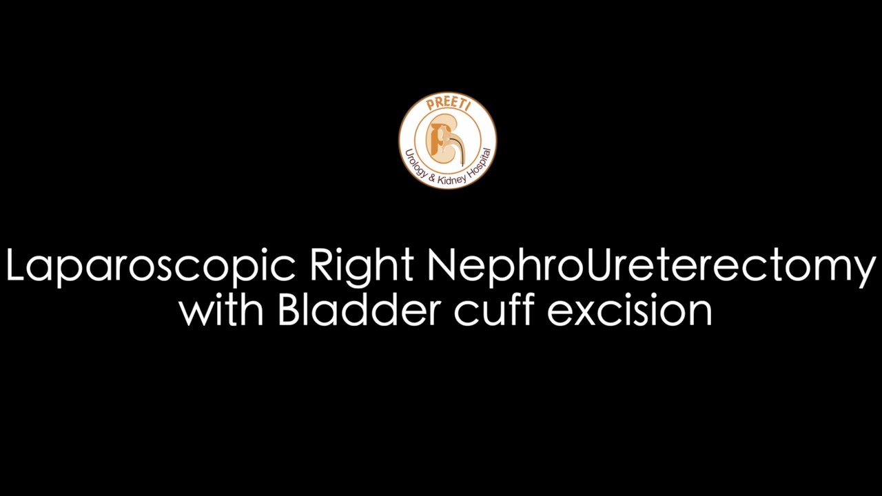 Laparoscopic Right NephroUreterectomy with Bladder cuff excision with ...