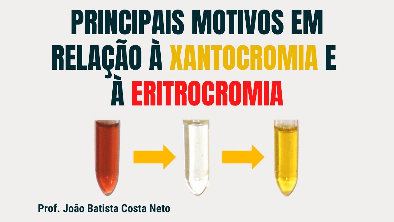 Principais Motivos em relação à Xantocromia e à Eritrocromia - YouTube