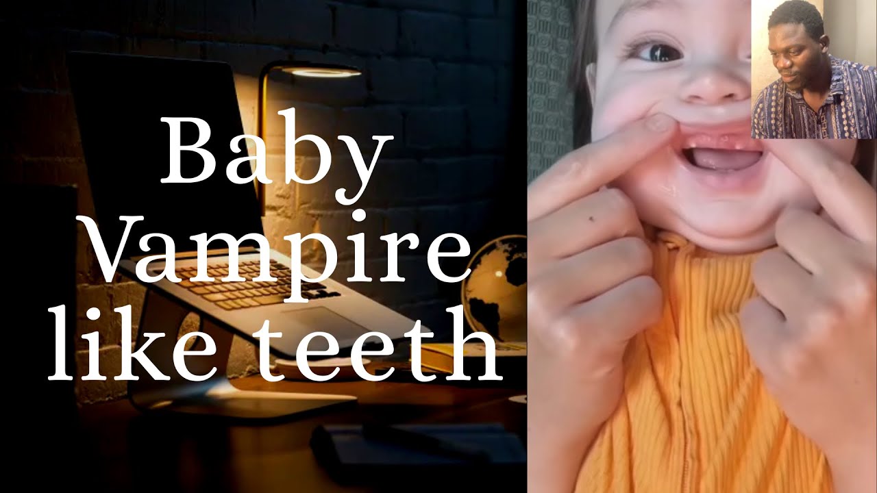 Baby’s vampire-like teeth - YouTube