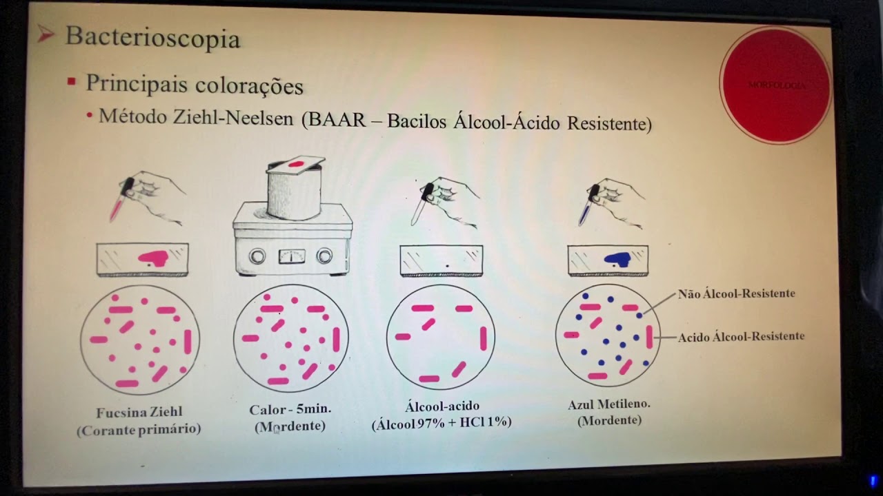 Aula 06: Principais colorações usadas em microbiologia 2/2 (Biomedicina ...