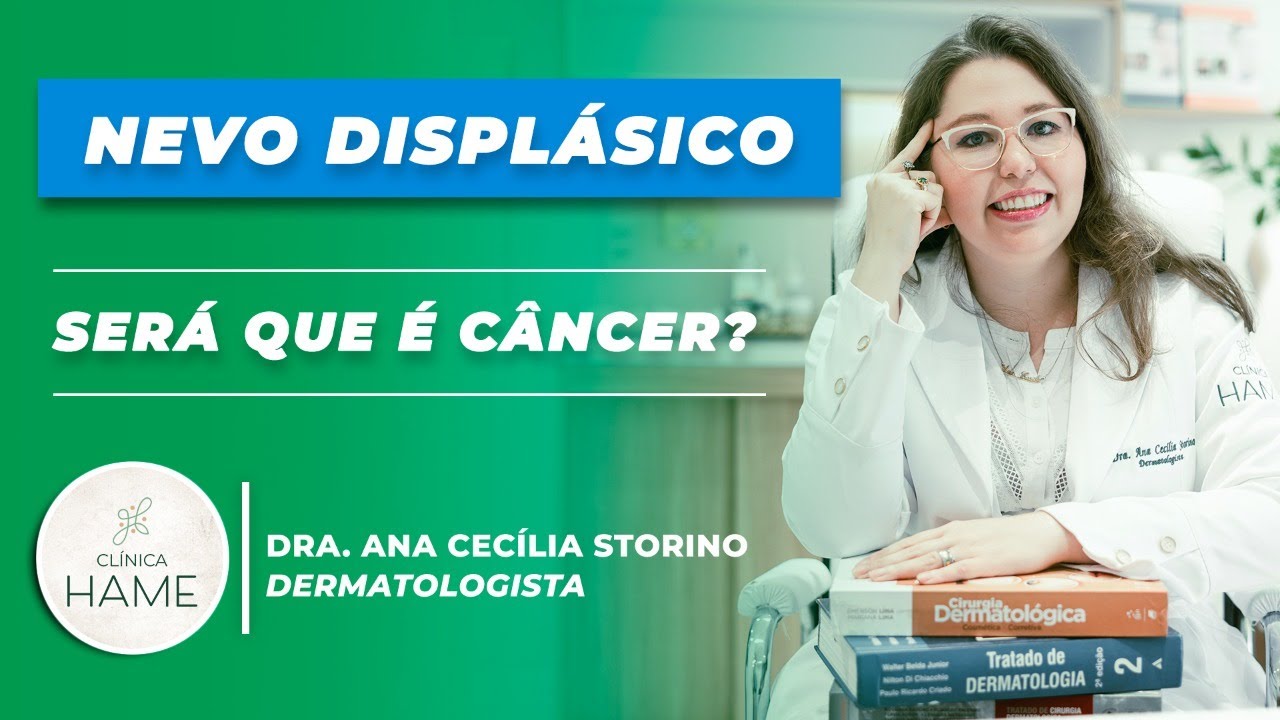 Nevo displásico é câncer? | Saiba quando um sinal na pele pode ser um ...