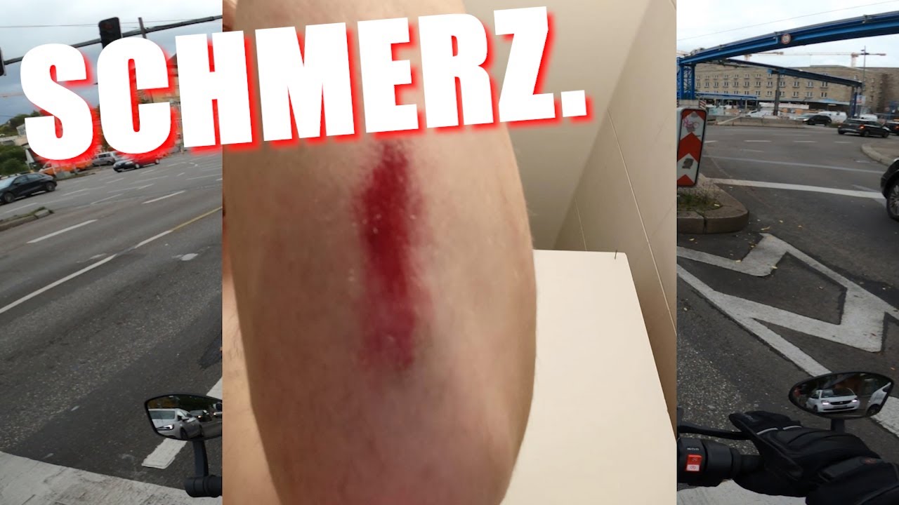 Das sind meine Verletzungen.. [JULI] - YouTube