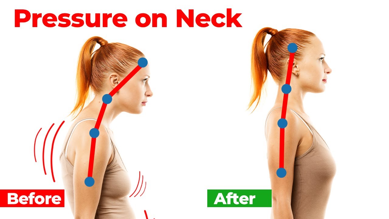 FIX THIS. BEFORE IT’S TOO LATE. Stop Rounded Posture - YouTube