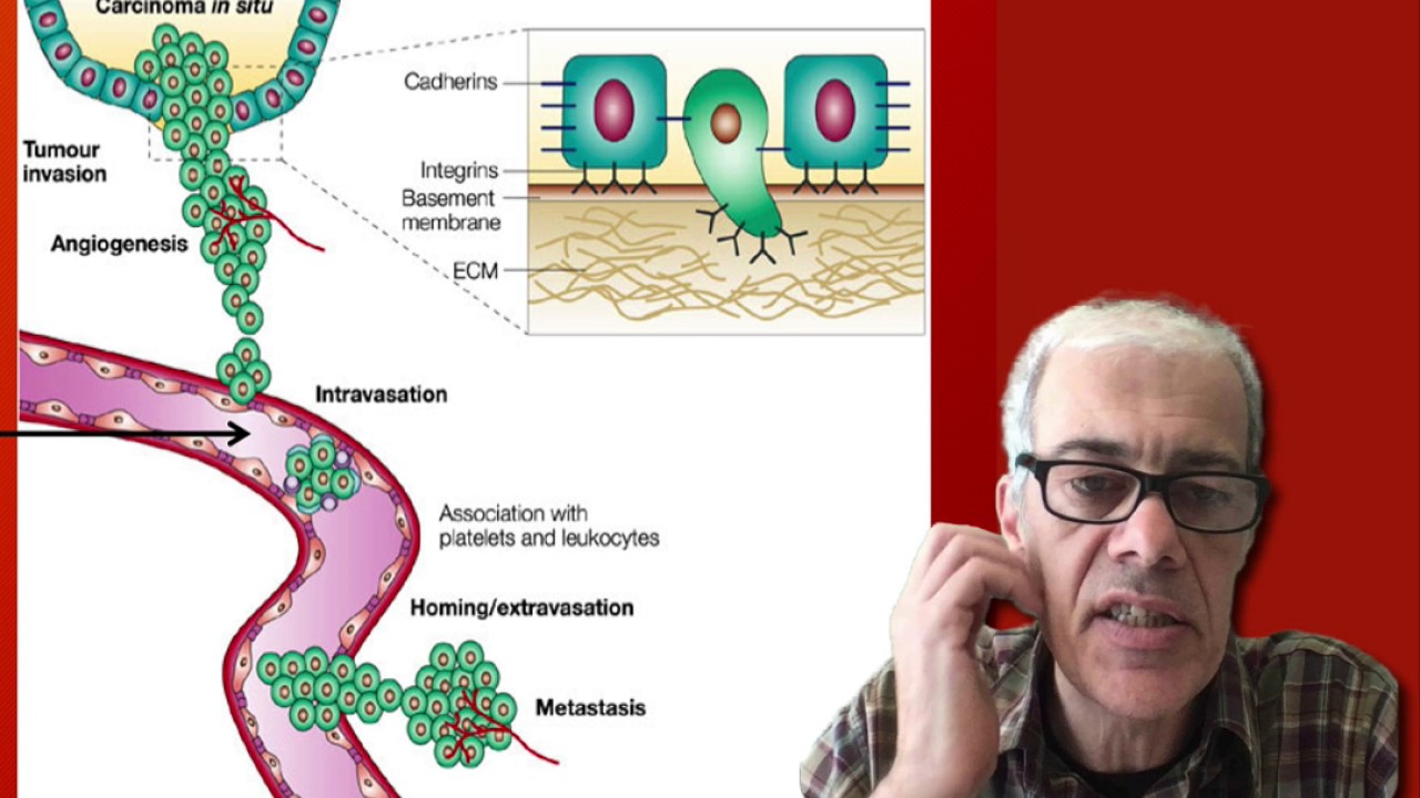 1.6 Metastasis and Angiogenesis - YouTube
