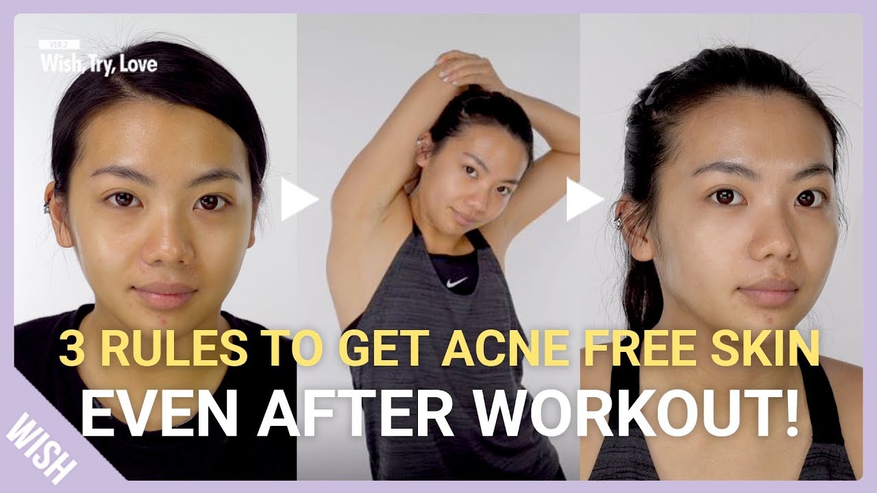 Top 3 Acne Free & Ageless Skin Care Routine Rules to Keep Before ...