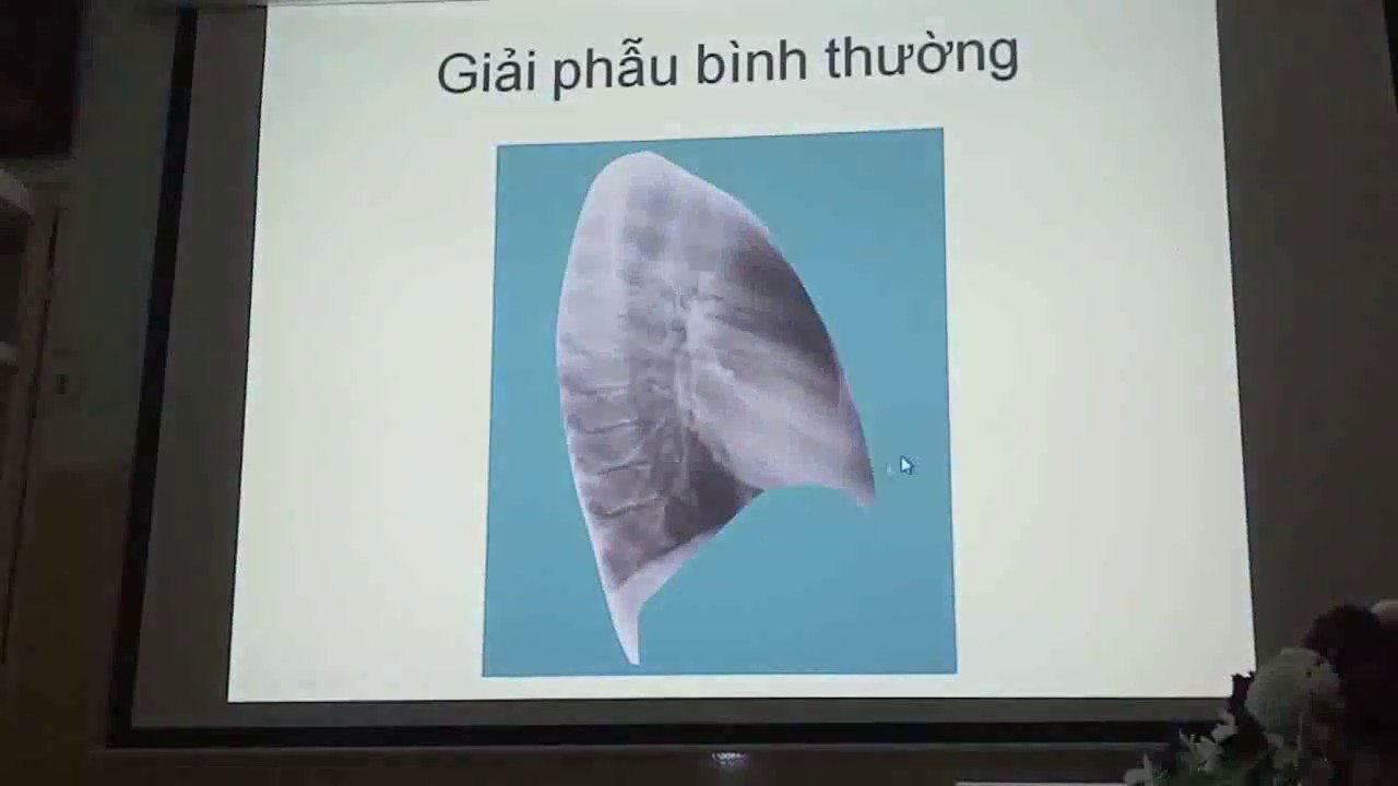 XẸP PHỔI - YouTube