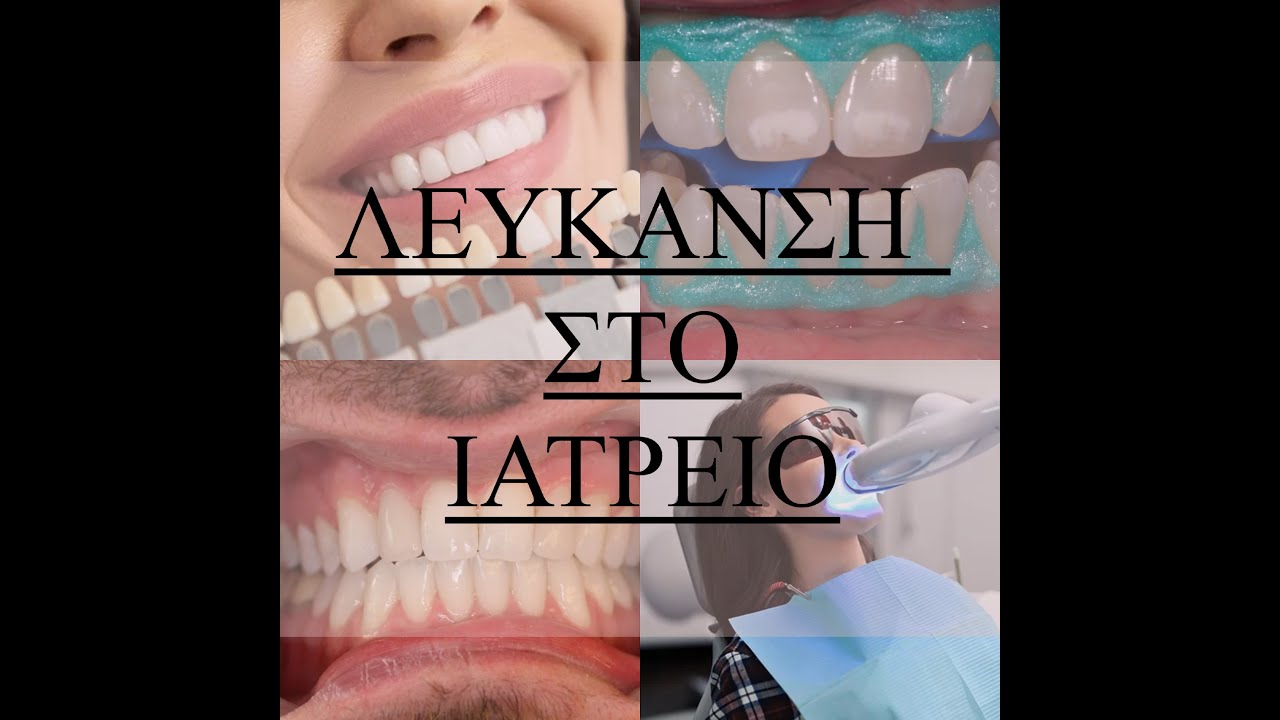 Λεύκανση δοντιών στο ιατρείο - YouTube