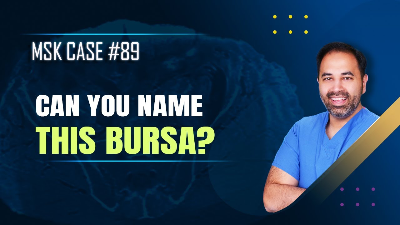 MSK CASE #89- What Is A Bursa? - YouTube
