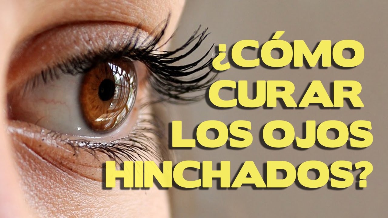Como curar los ojos hinchados 3 metodos para quitar la hinchazon - YouTube