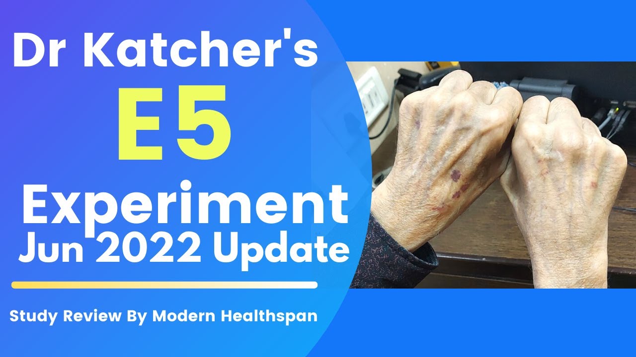 Dr Katcher's E5 Experiment June 2022 Update | Review By Modern ...