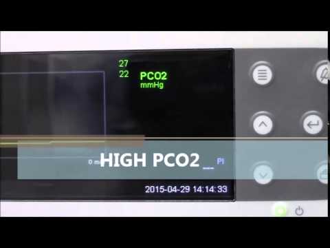 High PCO2 alarm in Sentec Digital Monitor - YouTube