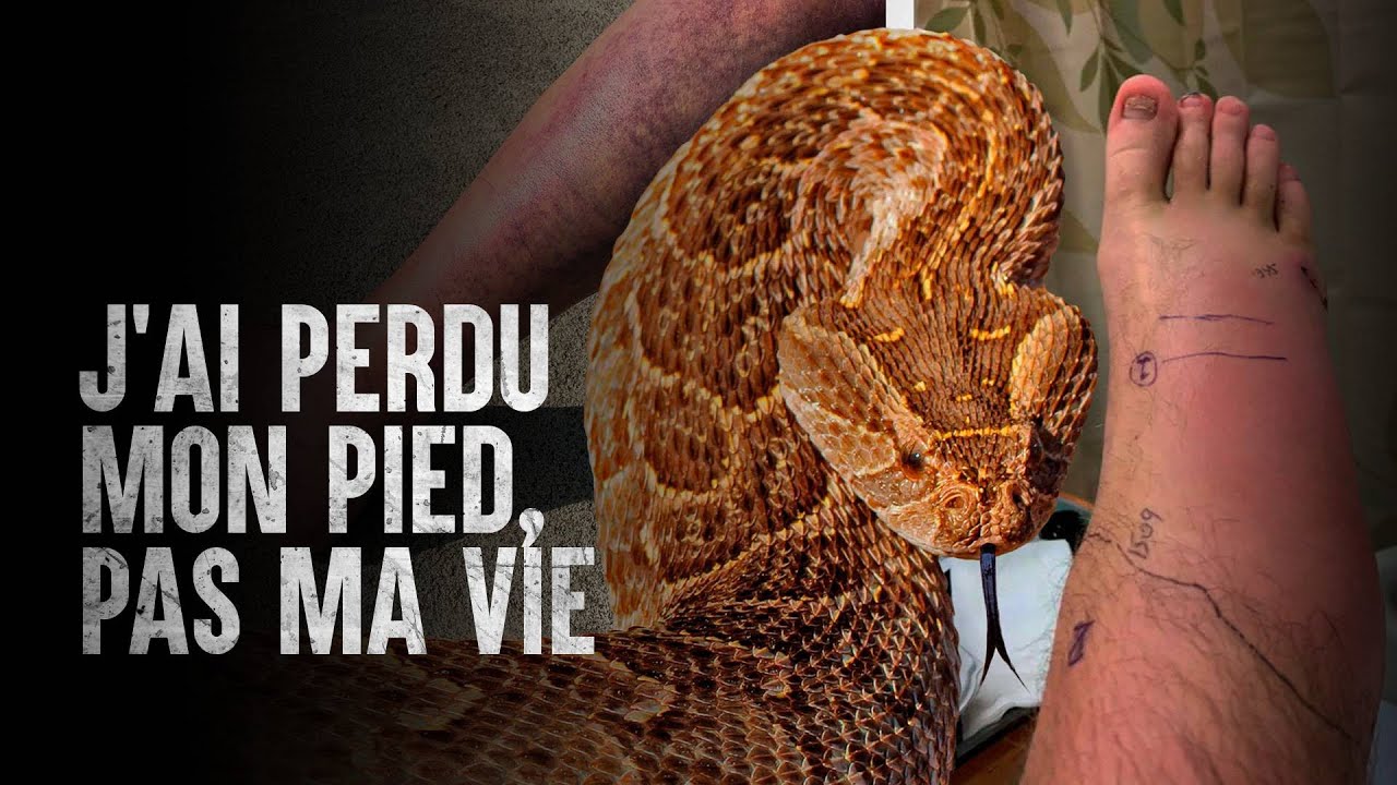 Les 5 morsures de serpent les plus dangereuses - YouTube