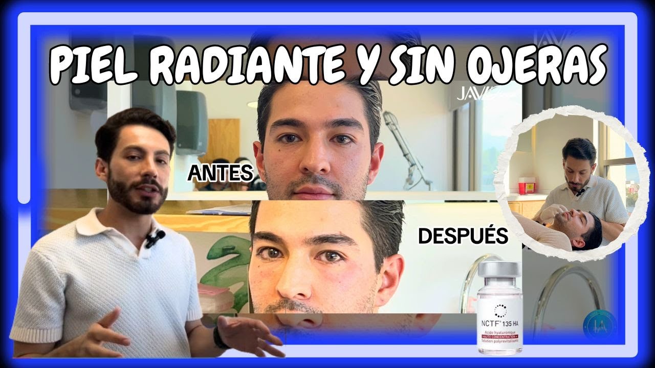 NCTF: TRATAMIENTO para tener una PIEL RADIANTE Y SIN OJERAS I JAVIER ...