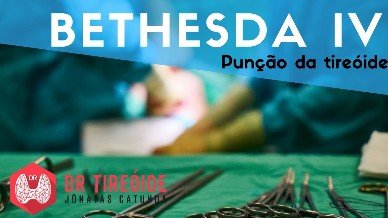 PAAF da tireóide Bethesda IV - Neoplasia Folicular! | Dr Jônatas ...