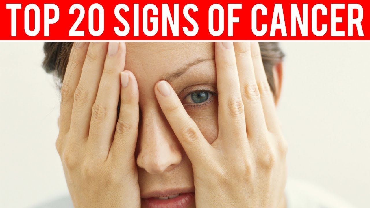 20 Early Warning Signs of Cancer You Don't Want To Ignore - YouTube