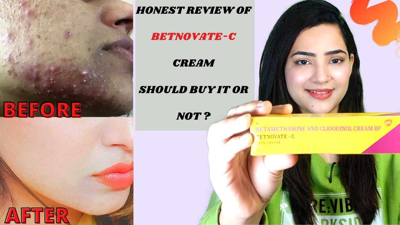 Betnovate C Cream HONEST Review | Betnovate C Cream Uses, Side Effects ...