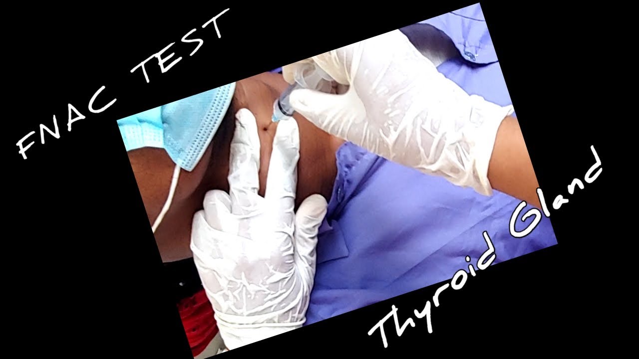 FNAC FOR THYROID GLAND।। - YouTube