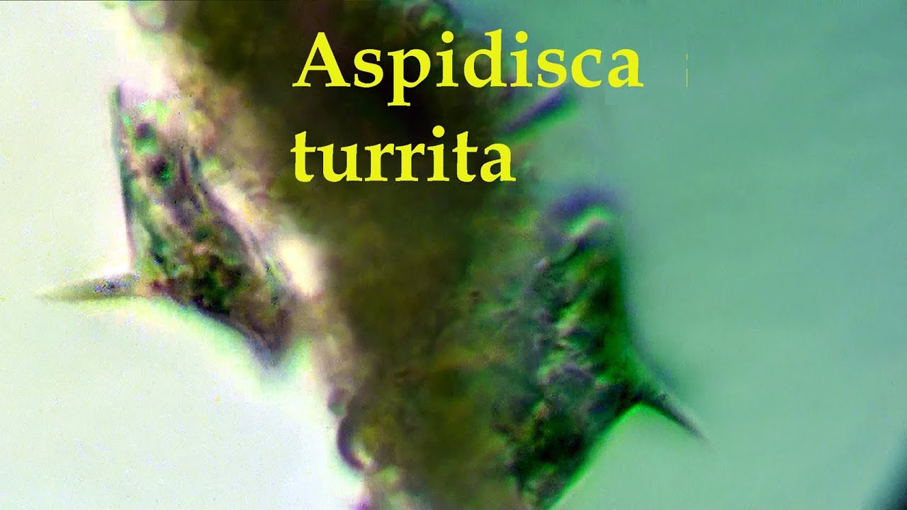 Aspidisca turrita - YouTube