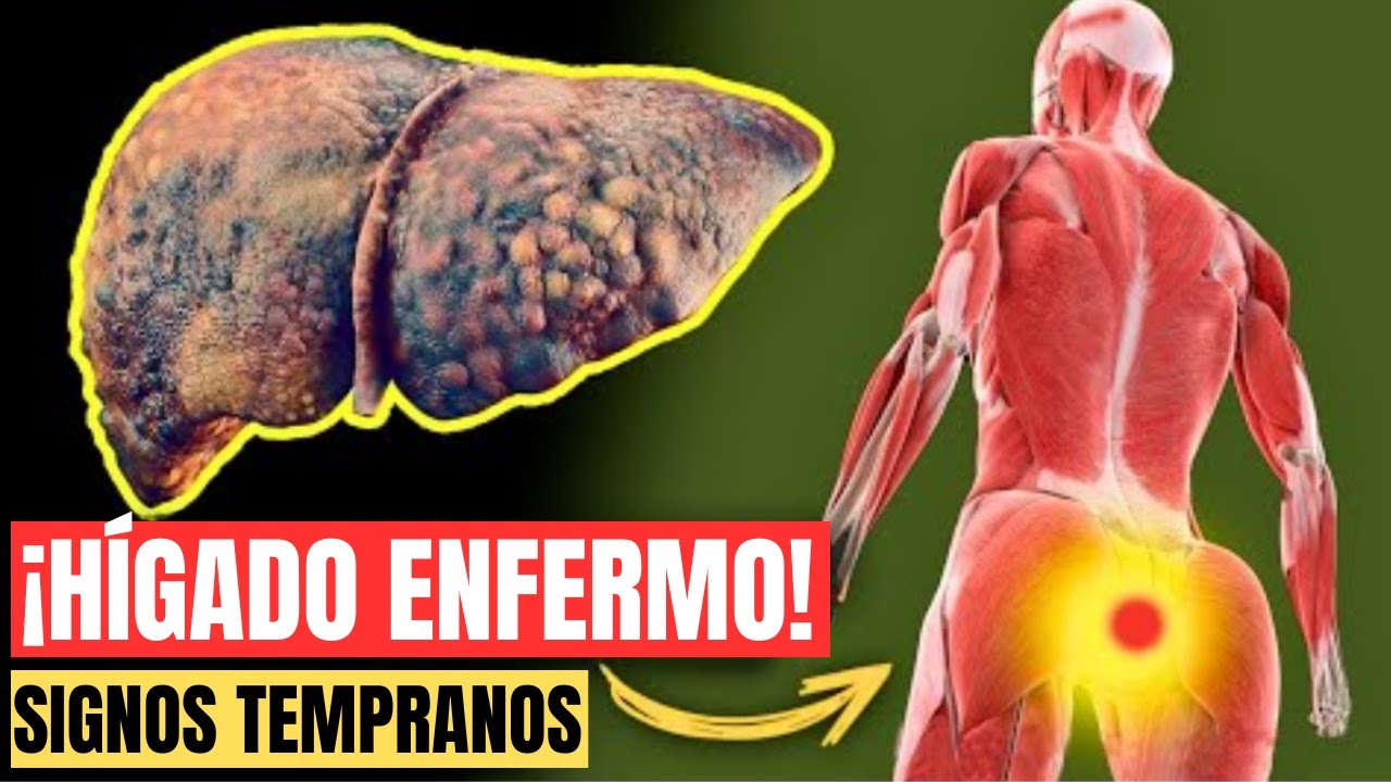 ¡HÍGADO MURIENDO! 12 Signos Extraños de HÍGADO ENFERMO - YouTube