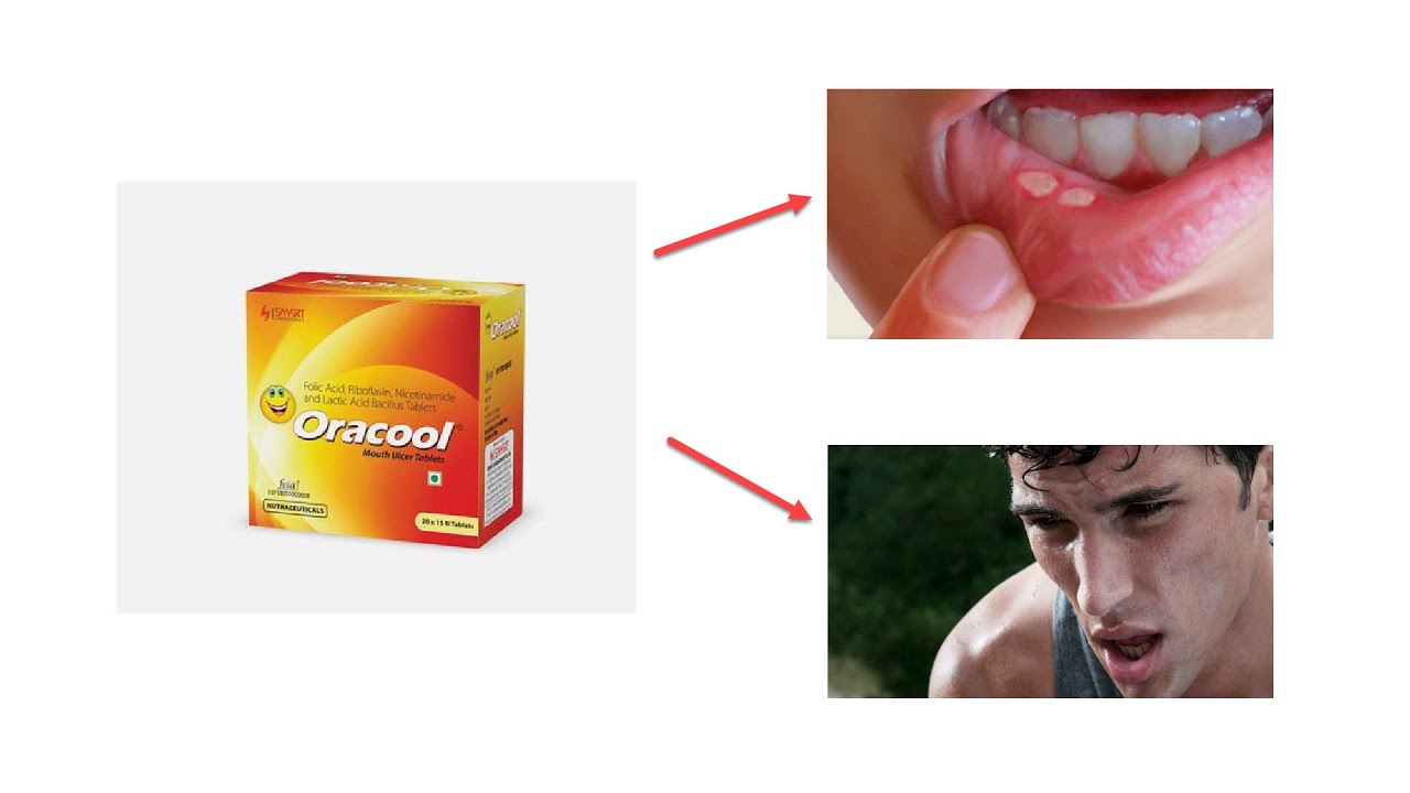 Oracool Tablets - Uses, Side Effects, Composition, and Review - YouTube