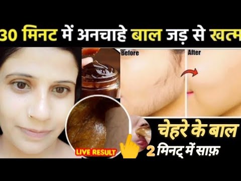 Facial Hair remove at home | How to Reduce Facial Hair Naturally ...