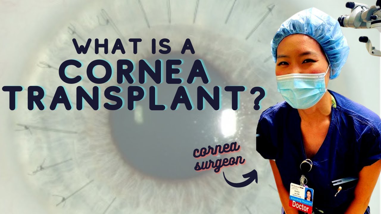 Cornea Surgeon Explains... What is a Cornea Transplant? | Top 3 Reasons ...