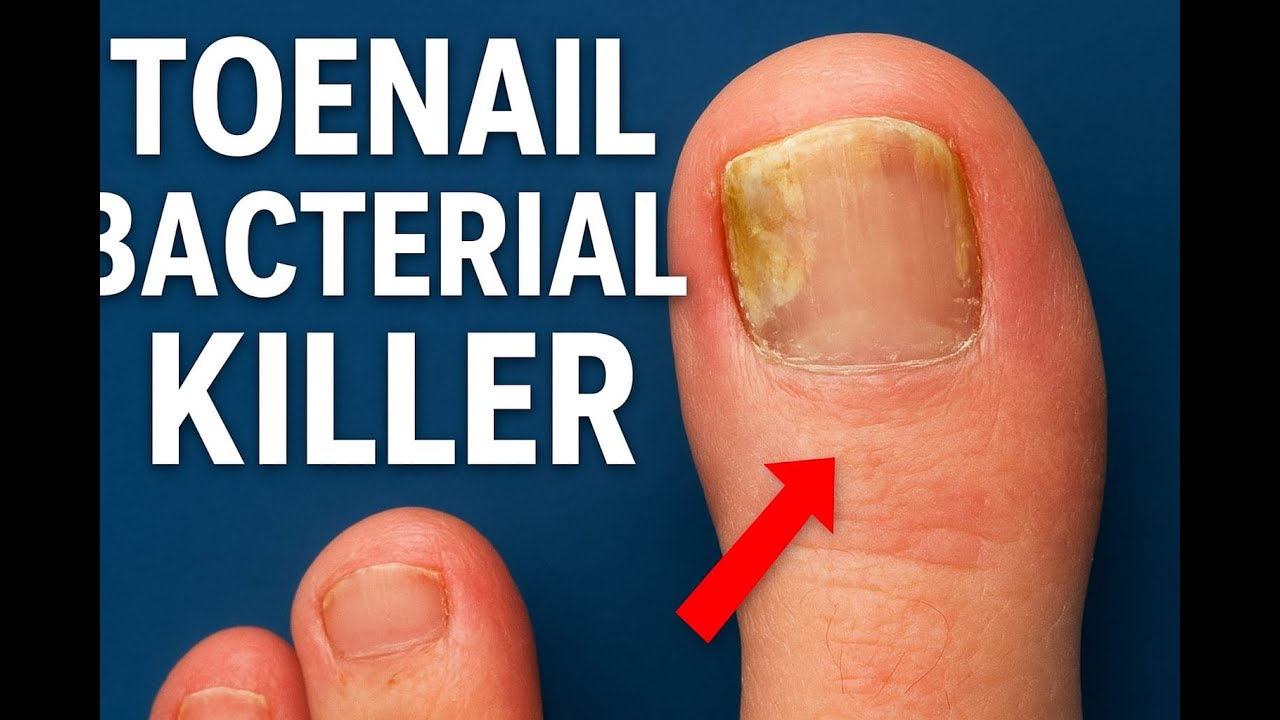 TOENAILS BACTERIA KILLER BY Barbara O’Neill - YouTube