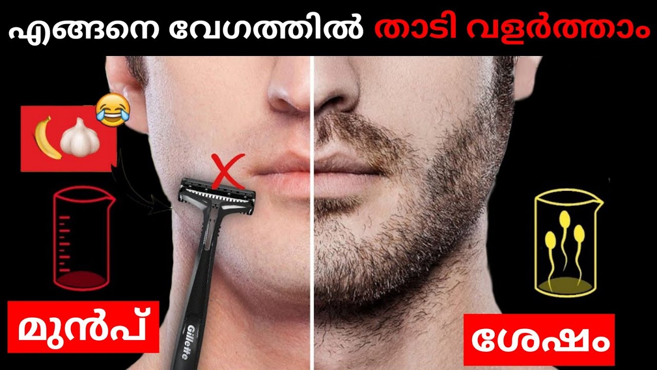 How To Grow A Beard Fast And Naturally Time For Greatness Youtube