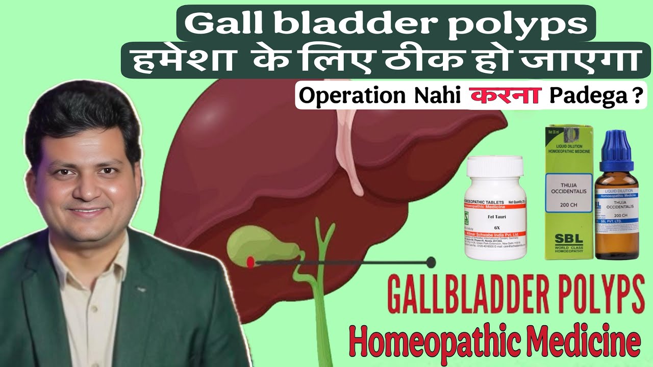 Gall bladder Polyps | Best Homeopathic Medicine for Gall bladder Polyp ...