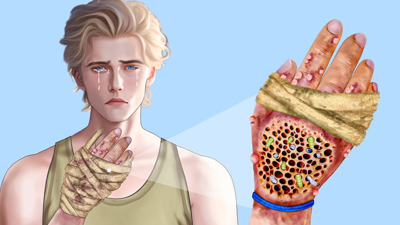 ASMR Worm & Maggot Hand Infected | Deep Cleaning Animation - YouTube