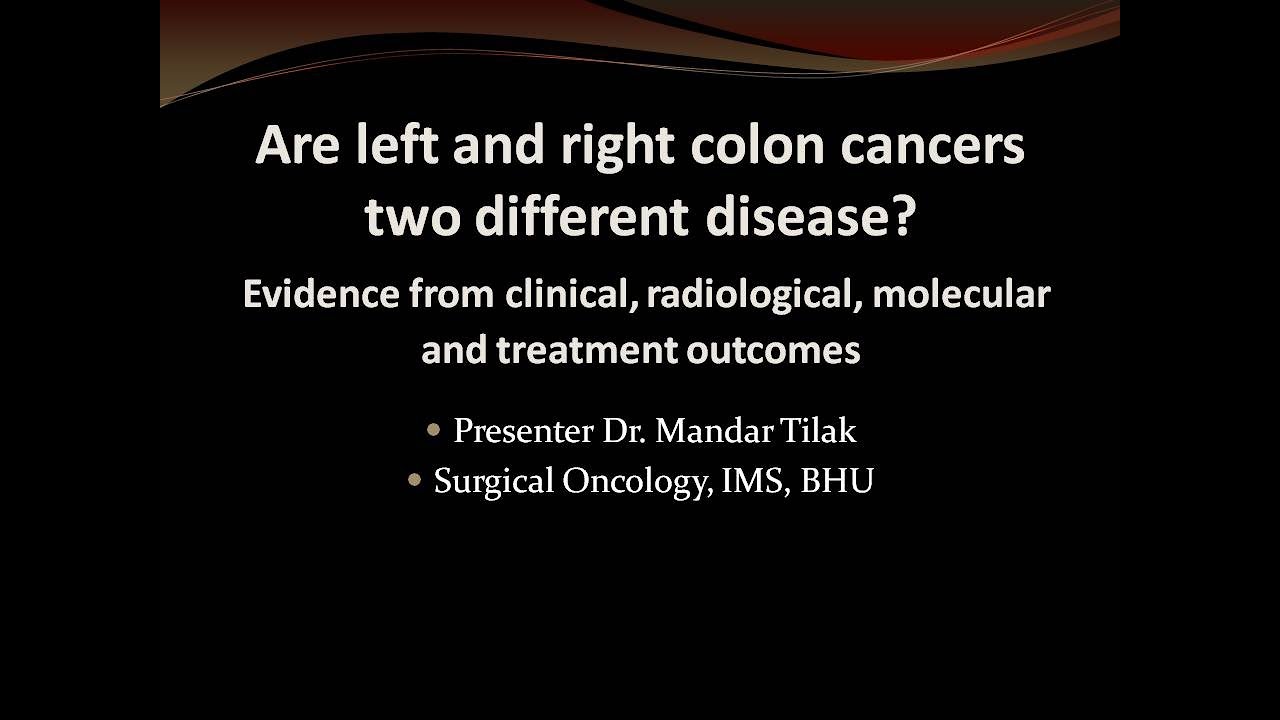 Are left and right colon cancers two different diseases? - YouTube