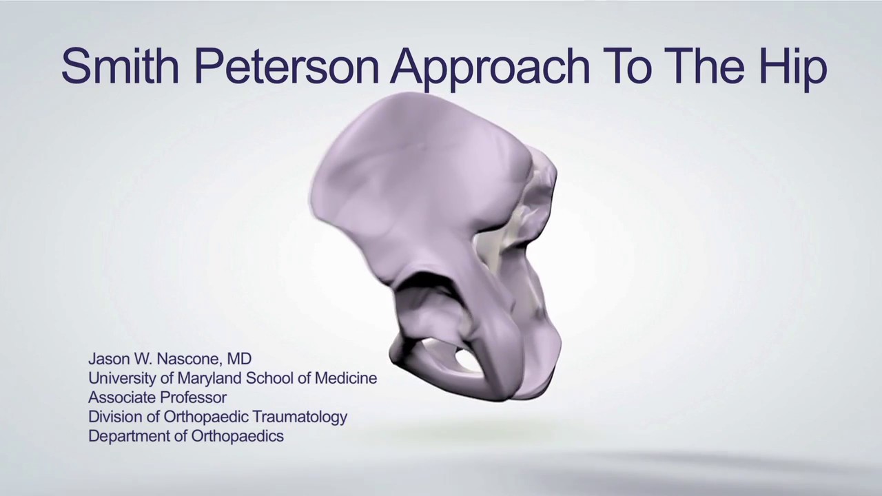 Smith Peterson Approach to the Hip - YouTube