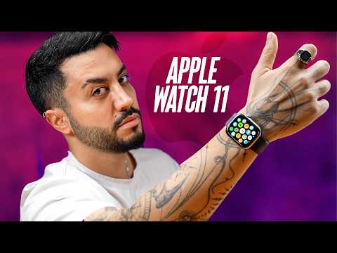 APPLE WATCH 11 ALDIM !!