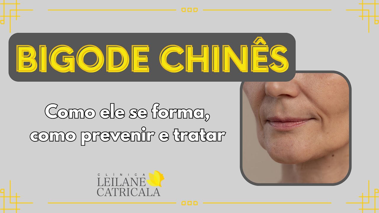 Como Evitar e Combater o Bigode Chinês? - YouTube