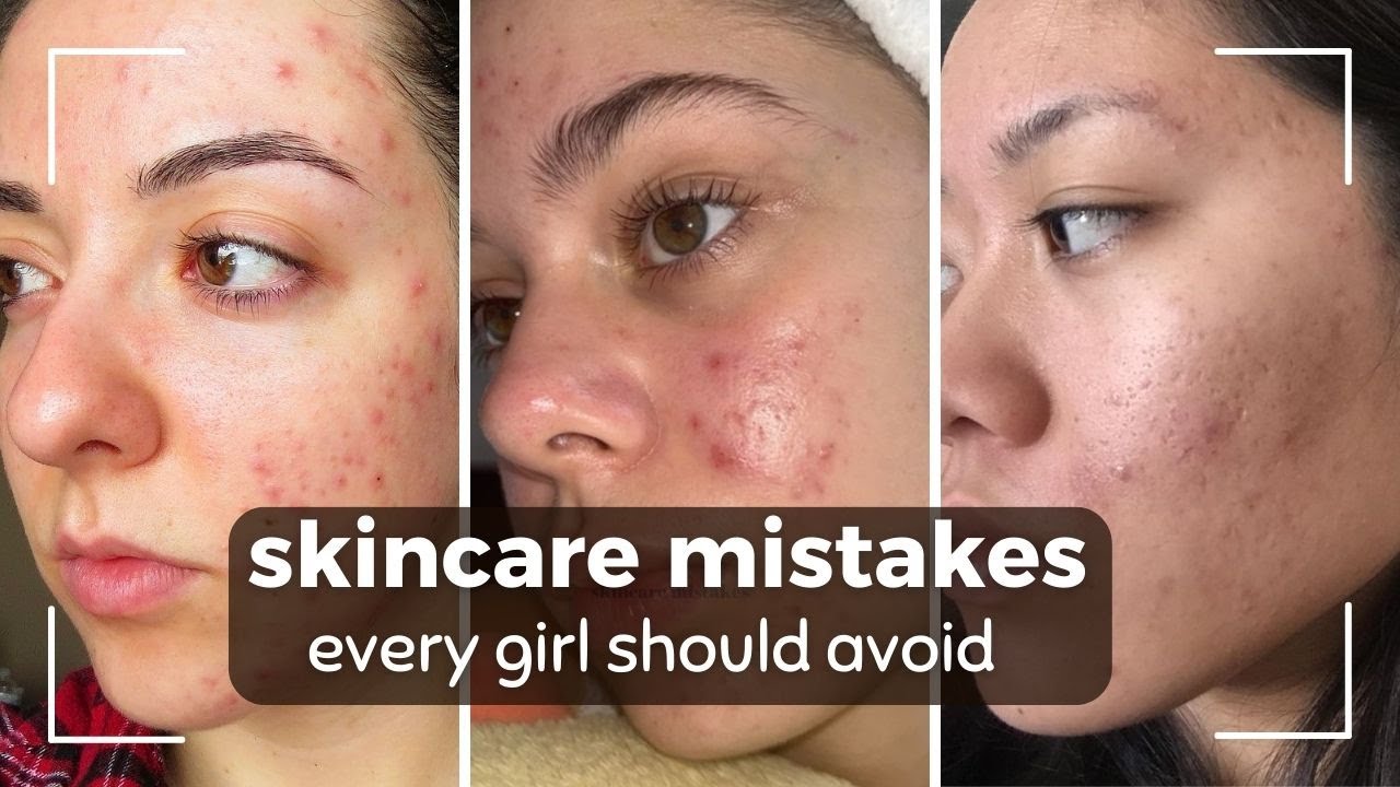 10 skincare mistakes to avoid for Clear Skin - YouTube