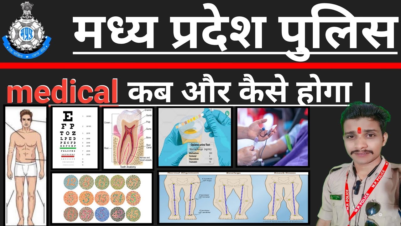 mp police medical || मेडिकल में क्या क्या होगा|| kaise hota hai || # ...