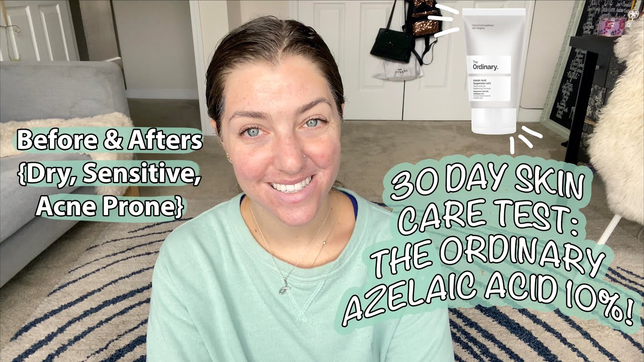 Azelaic Acid Before And After