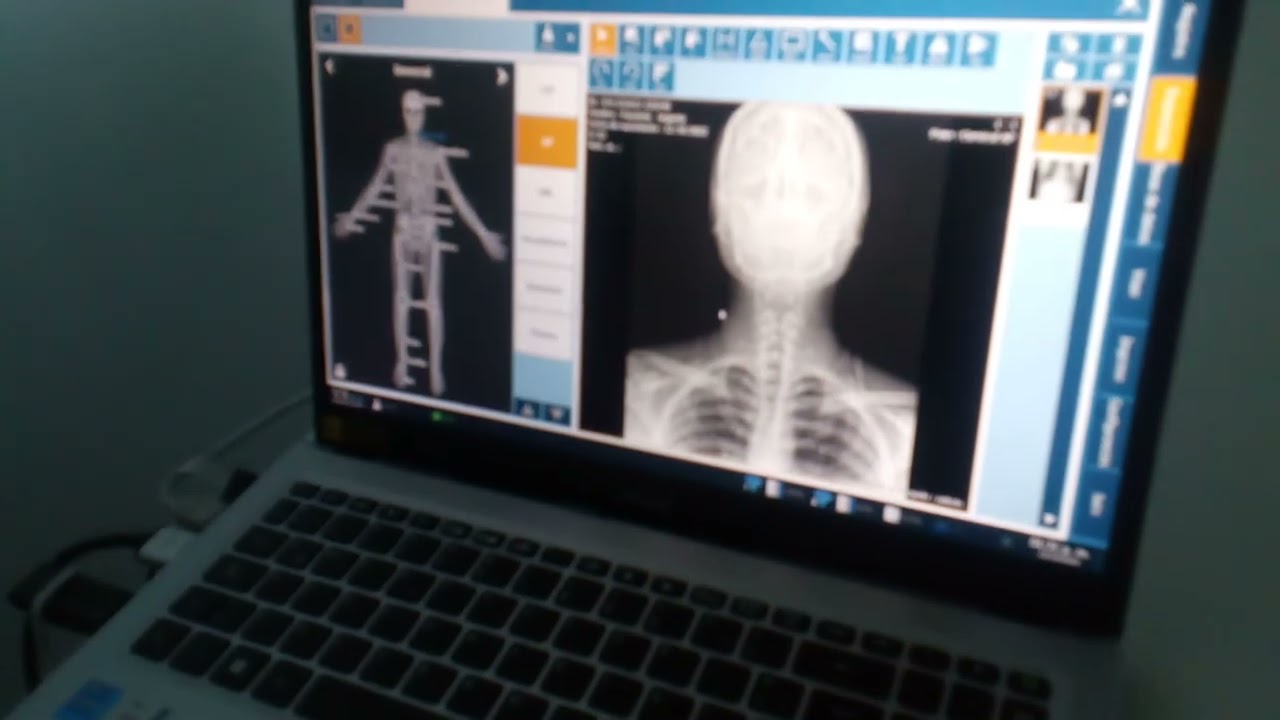 flat panel Rayos X - YouTube