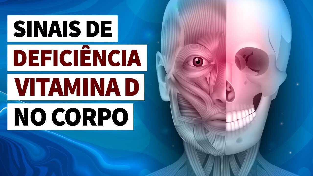 13 Sinais Alarmantes Que Indicam Deficiência De Vitamina D No Organismo Youtube