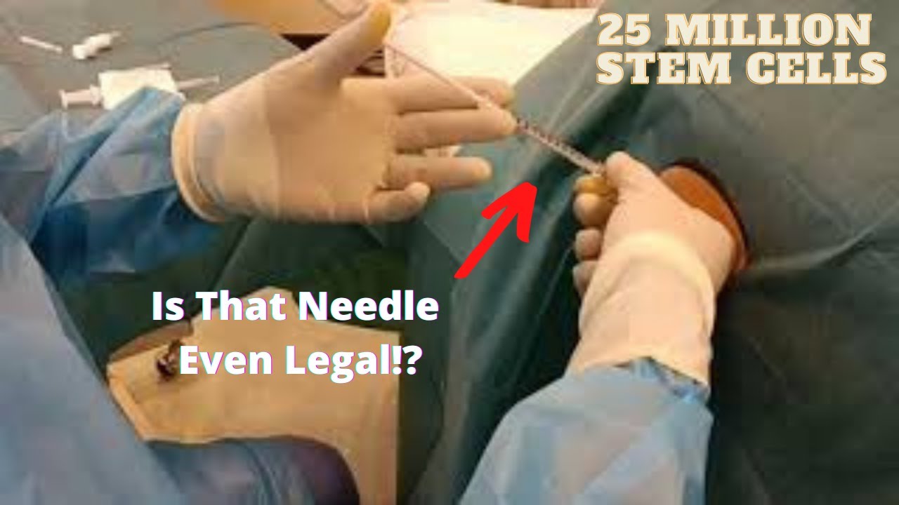 Stem Cell Spinal Injection - YouTube