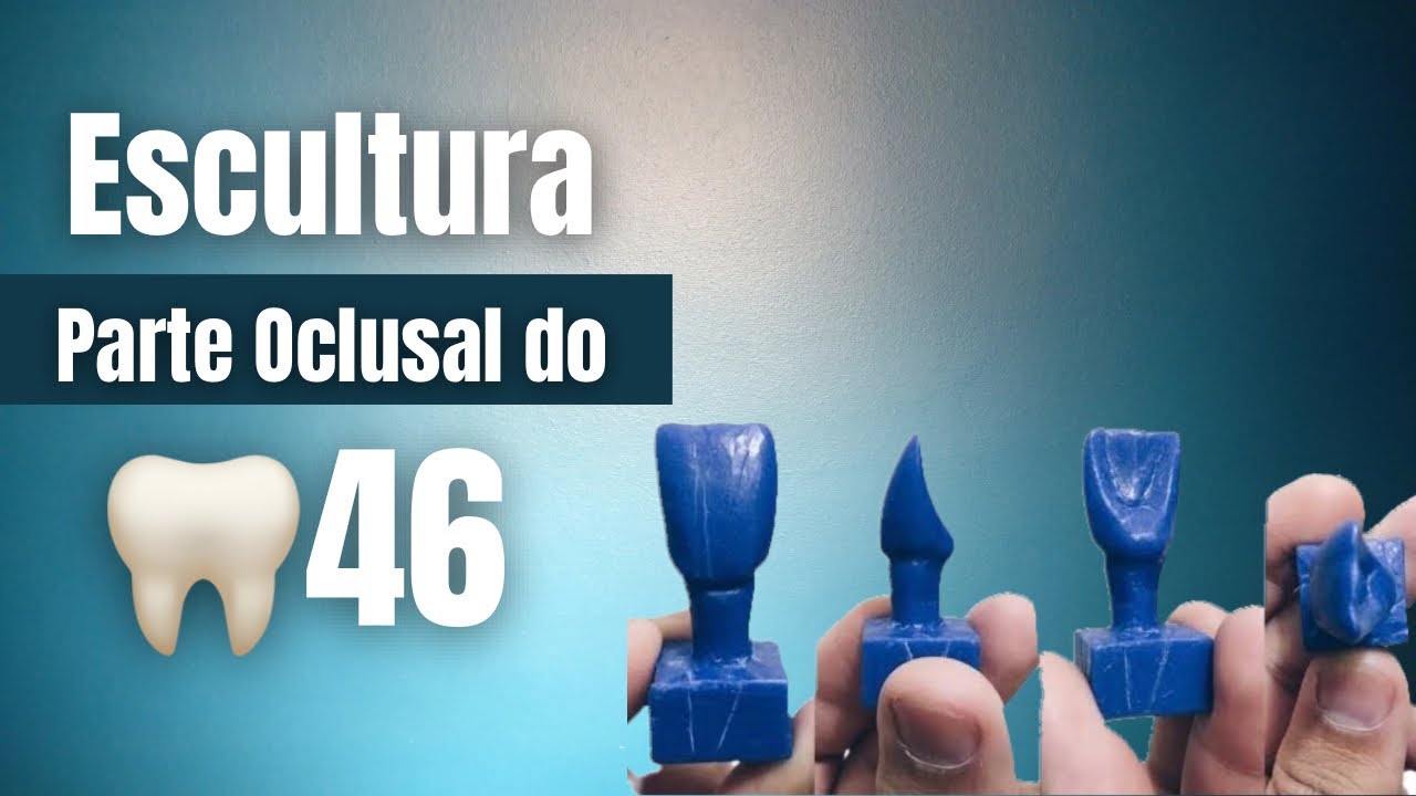 Escultura da parte oclusal do dente 46 - YouTube