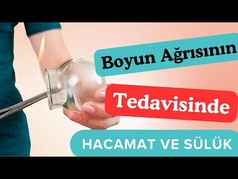 BOYUN AĞRILARI | Boyun ağrısı tedavisinde sülük ya da hacamat tavsiye eder misiniz?
