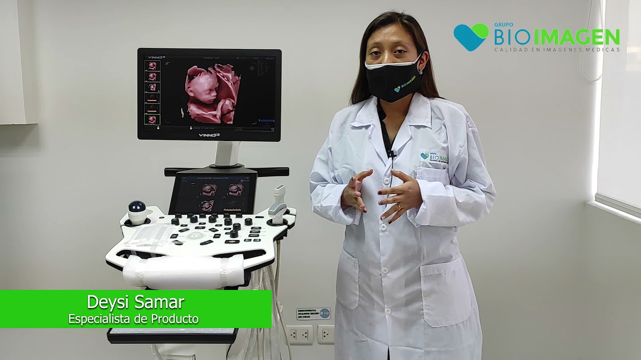 Características del VINNO X2 - YouTube