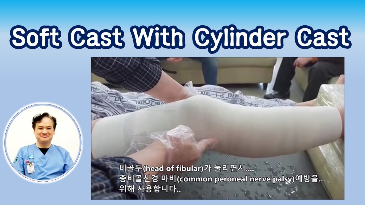Soft Cast With Cylinder Cast - YouTube
